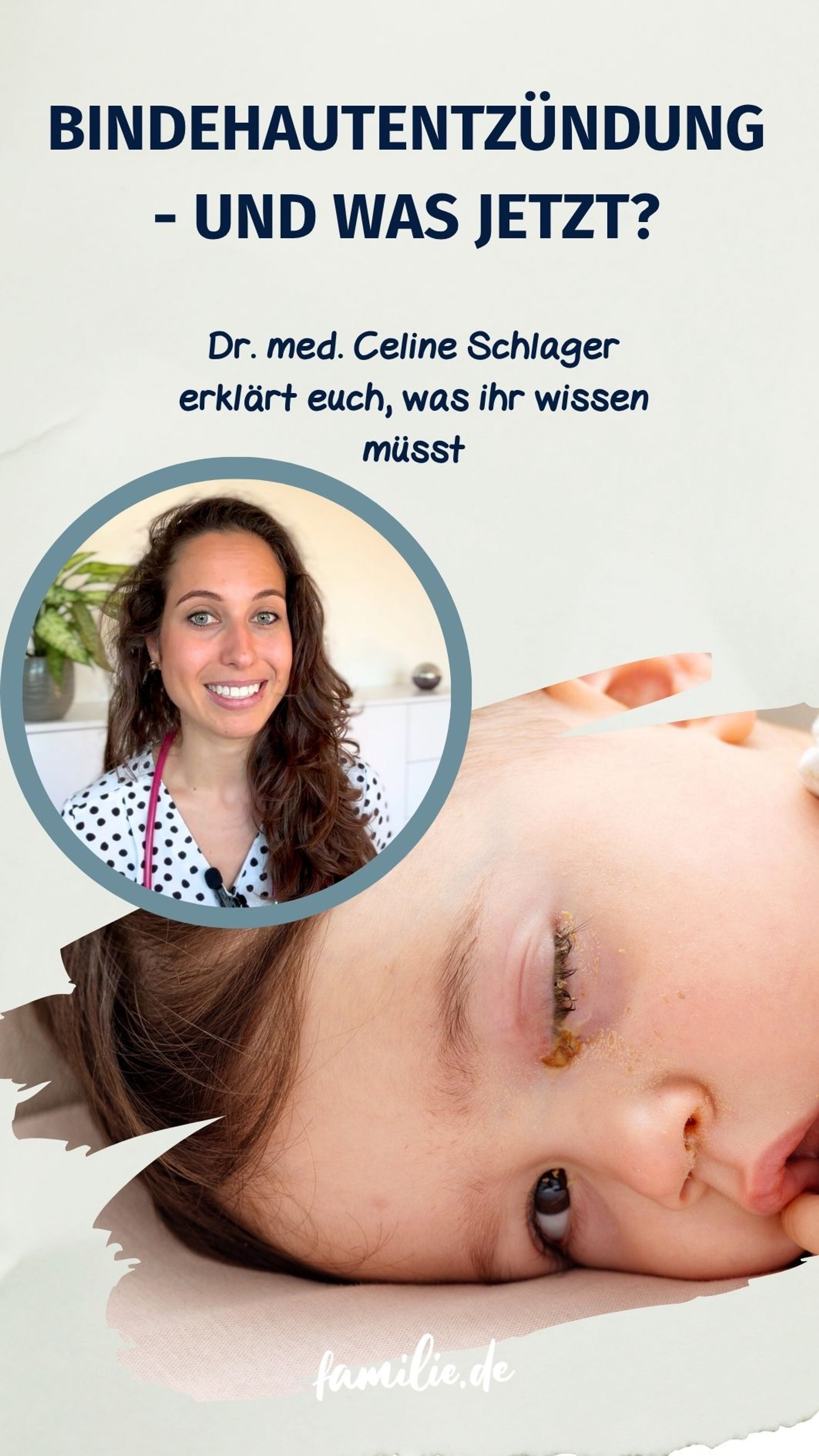 Bindehautentzündung bei Kindern: Wie behandeln?